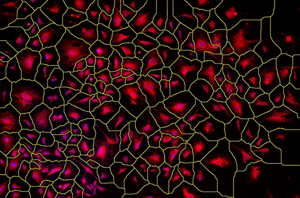 6) NIS Elements GA3 Dictionary – Binary Processing – UMassLMF.DEV
